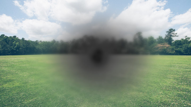 Age Related Macular Degeneration ARMD We Fix Eyes Age Related Macular Degeneration ARMD We Fix Eyes