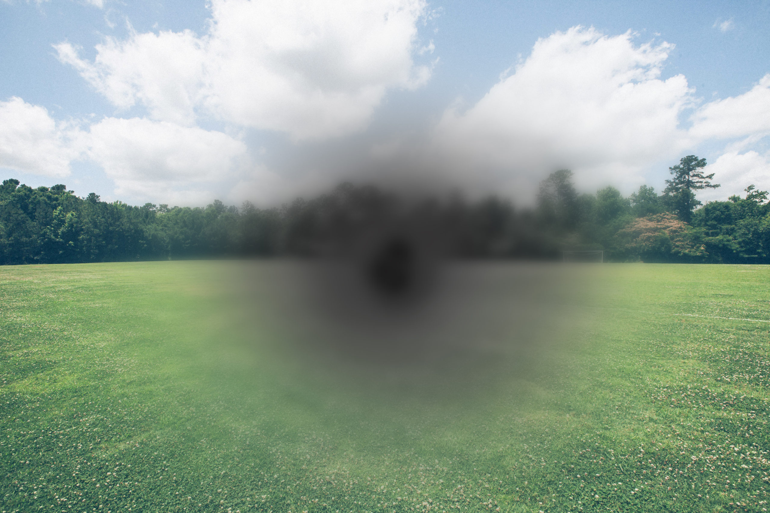Age Related Macular Degeneration ARMD We Fix Eyes